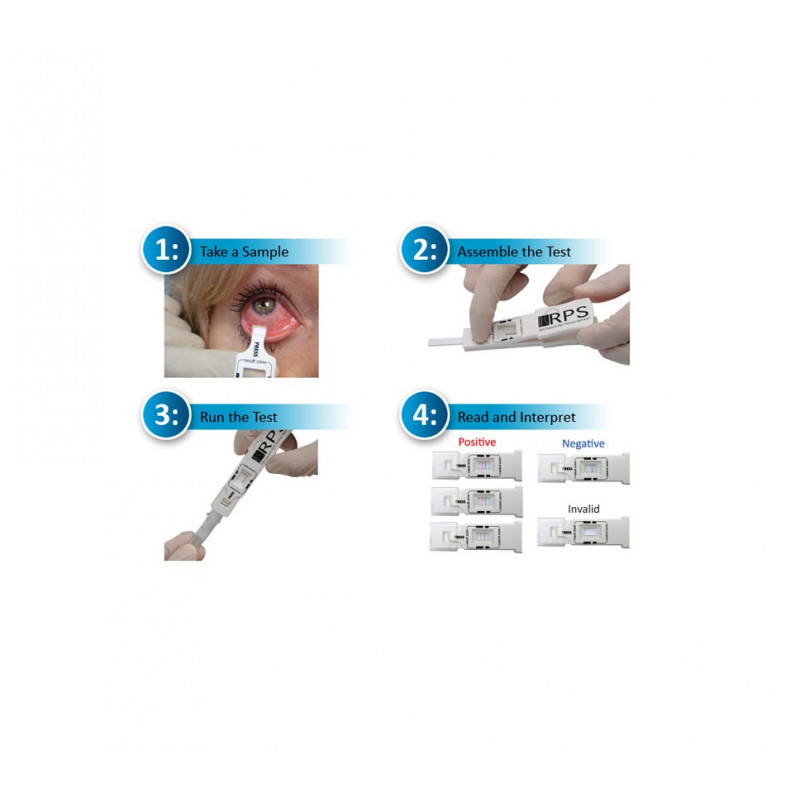 Test conjuntivitis adenoplus adenoviral -parafarmacia - salunatur