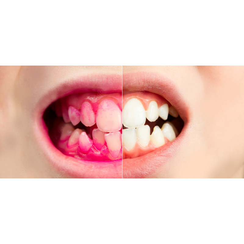 Plac control revelador dental 20 comprimidos - salunatur