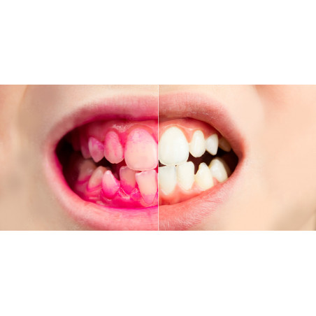 Plac control revelador dental 20 comprimidos - salunatur