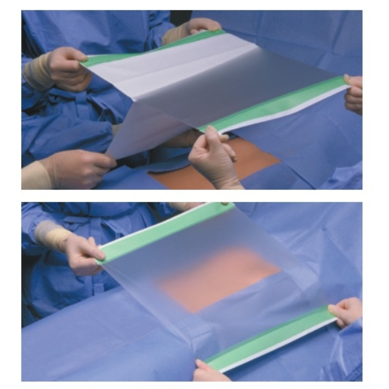 Campo quirúrgico Opsite Incise adhesivo 30 x 28 cm - salunatur