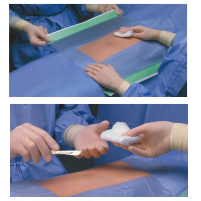 Campo quirúrgico Opsite Incise adhesivo 10 uds 45 x 28 cm - Salunatur